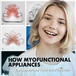 How Myobrace, Myosa and Other Myofunctional Appliances Can Transform ...